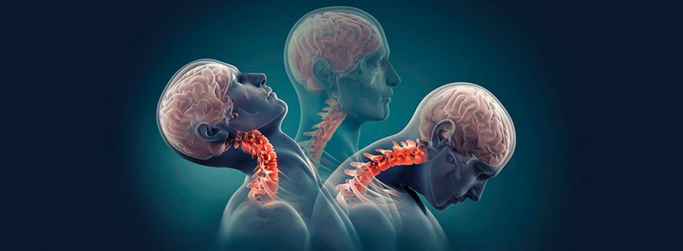 Prevención de las Lesiones Cervicales - Dr. Esteban Castro - Ortopedia ...